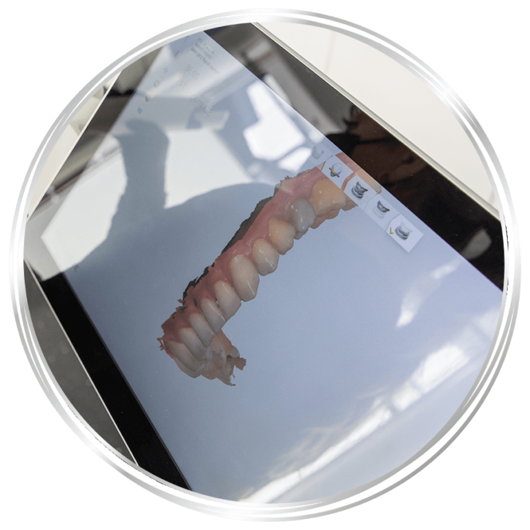 Digital Smile Design | Encino & West Hollywood, CA | Sargon Dental Digital Smile Design | Encino & West Hollywood, CA | Sargon Dental